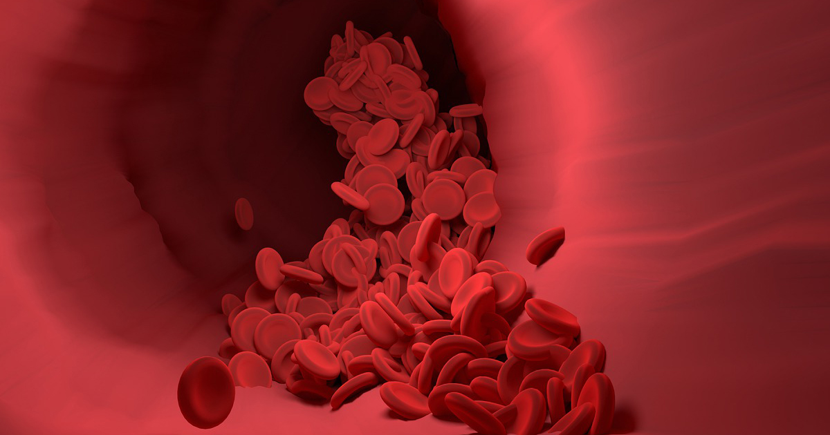 CAR-T liso-cel、再発・難治性大細胞型B細胞リンパ腫の2次治療に承認／BMS｜医師向け医療ニュースはケアネット